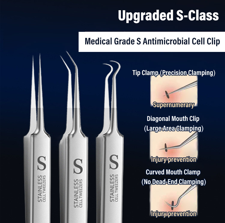 3-in-1 Stainless Steel Acne Blackhead Remover Kit/Cell Tweezers/Acne ...