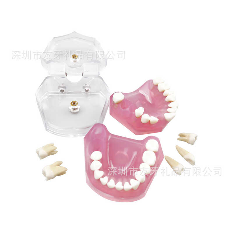 ooth Model Extraction Model Full Mouth Removable Tooth Model Soft Gum ...