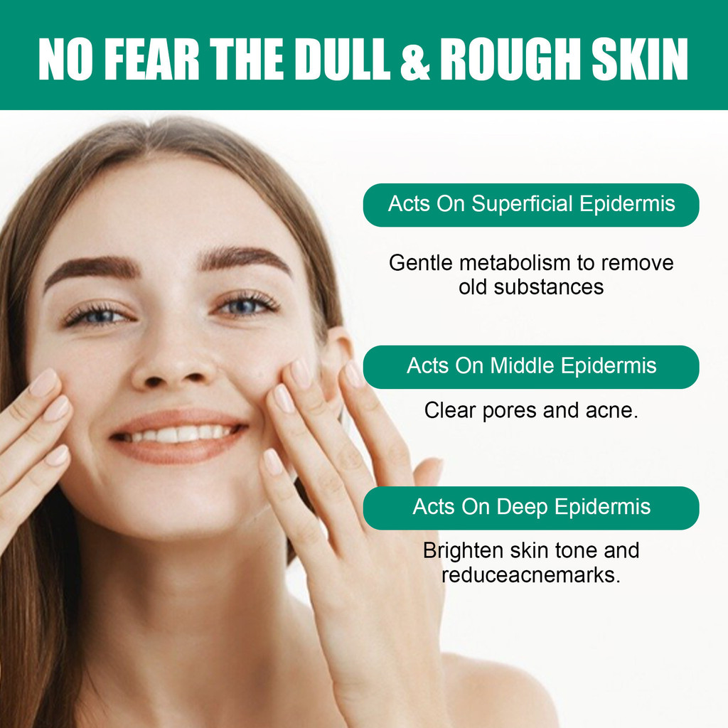Acne Face Cream Pimple Treatment Oil Control Repair Redness Remove ...