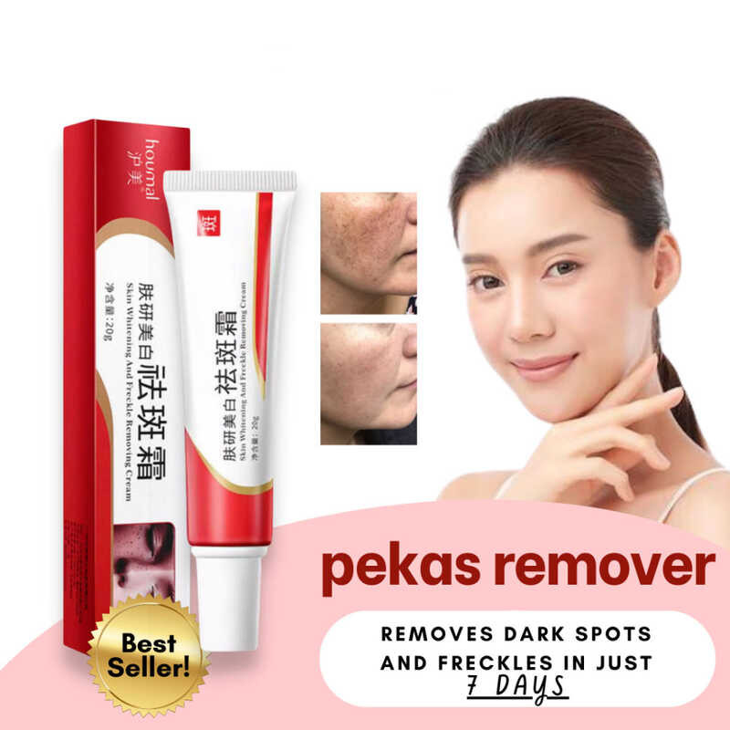 PEKAS REMOVER Effective Whitening & Freckle Remover Cream | Melasma ...
