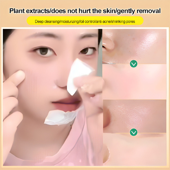 Pore Sucking Gel Blackhead Removal Nasal Strip Pore Cleansing | Shopee ...