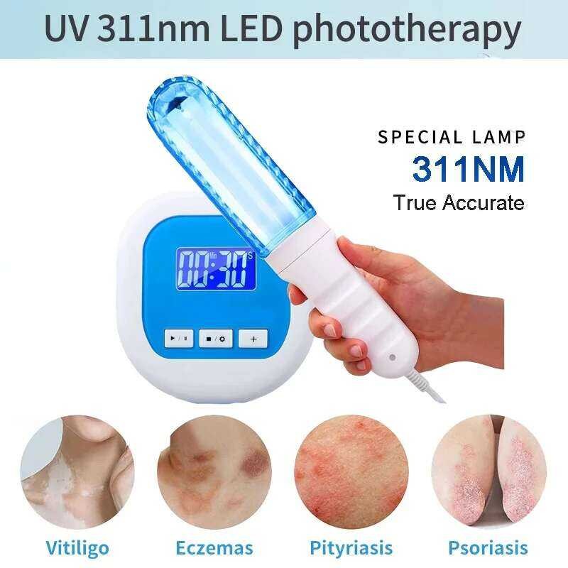 W 311Nm Treatment Lamp For Therapy Vitiligo Psoriasis Skin Disease B ...