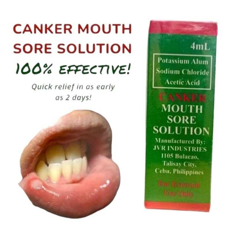 CANKER MOUTH SORE SOLUTION GAMUT SA SINGAW 4Ml Healthcare | Shopee ...
