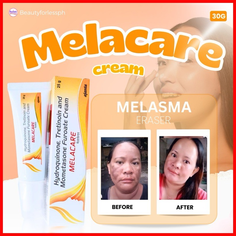 AUTHENTIC MelaCare Cream 25g Anti Melasma Cream Skin Whitening Face ...