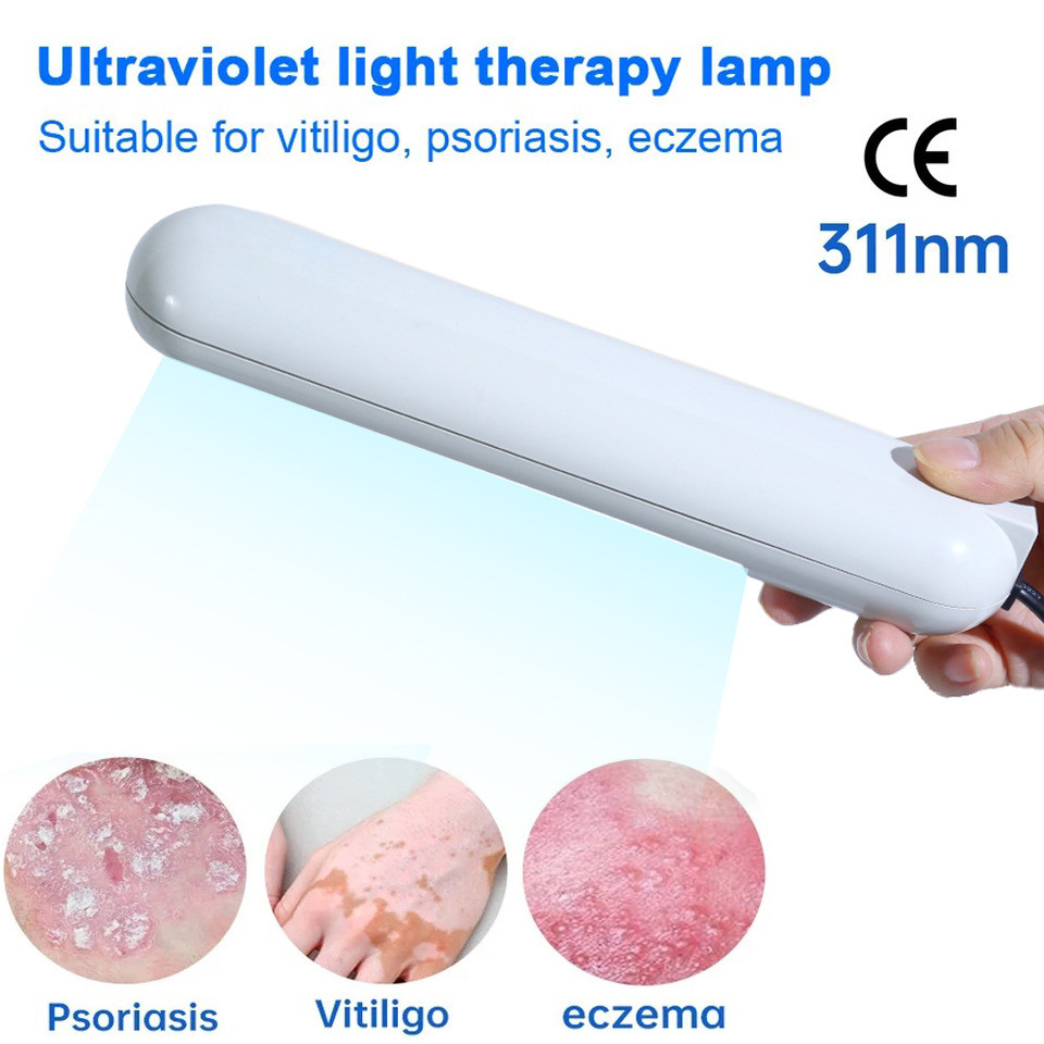 311nm Portable Excimer Laser UVB Phototherapy Machine Device UV Light ...