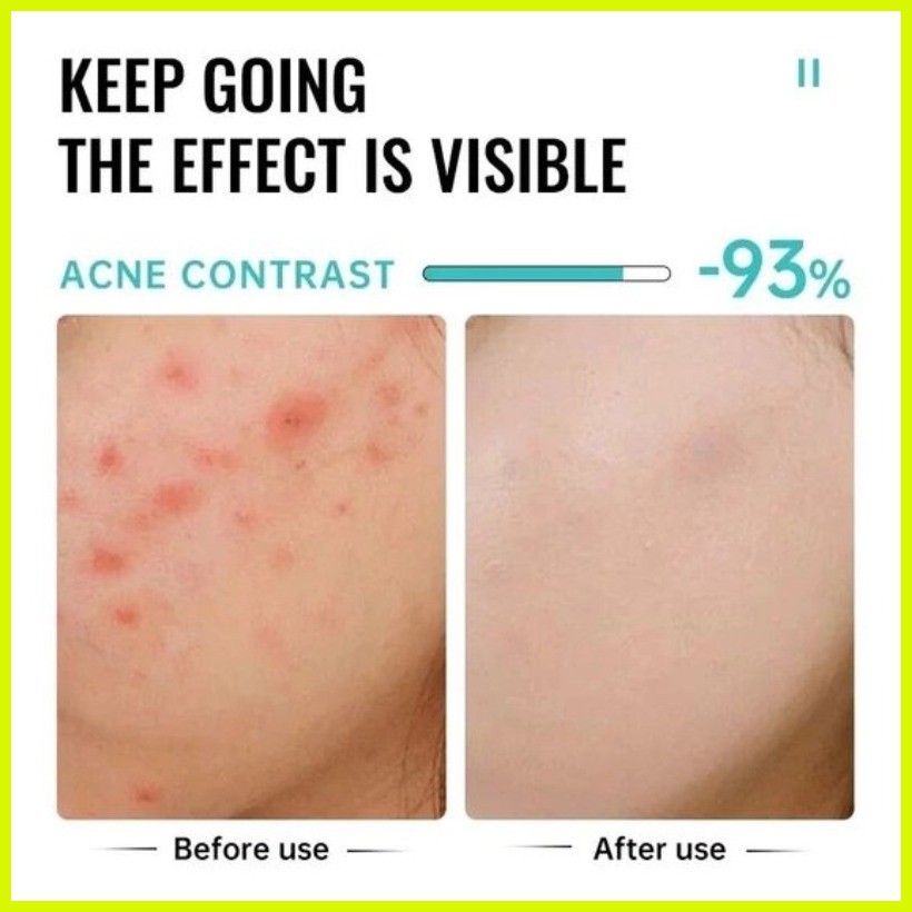 ♨ MOKIA Hydrating Hyaluronic Acid Serum & Resurfacing Retinol Serum ...