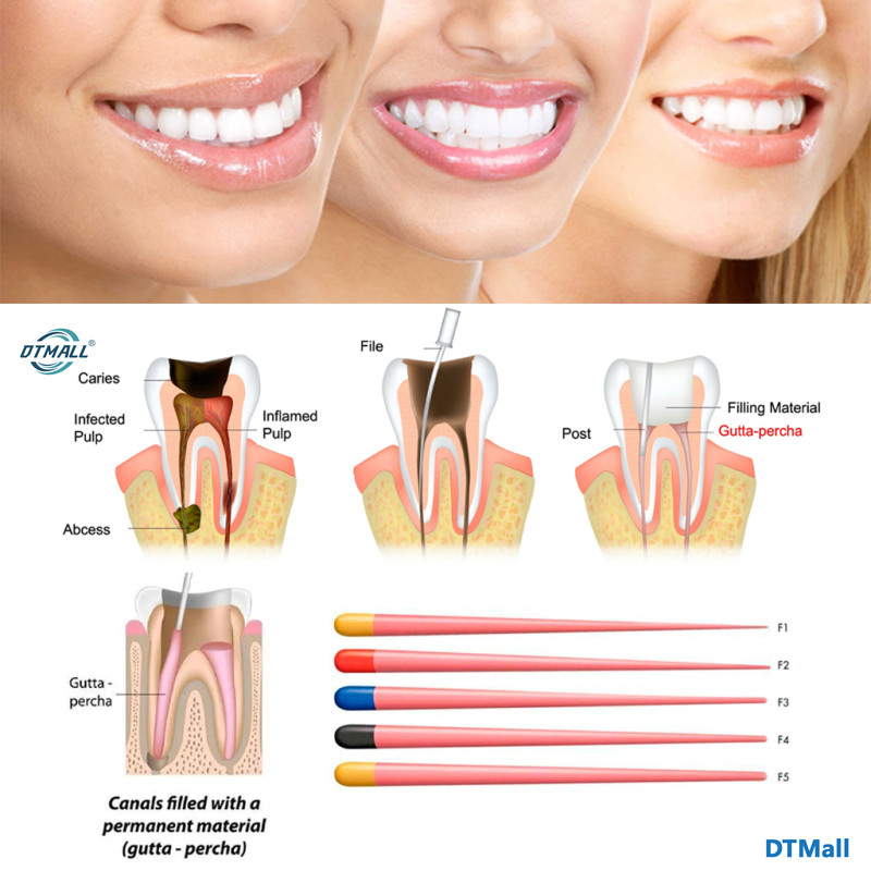 Dental Absorbent Paper Points/Gutta percha points F1-F3 for Protaper ...