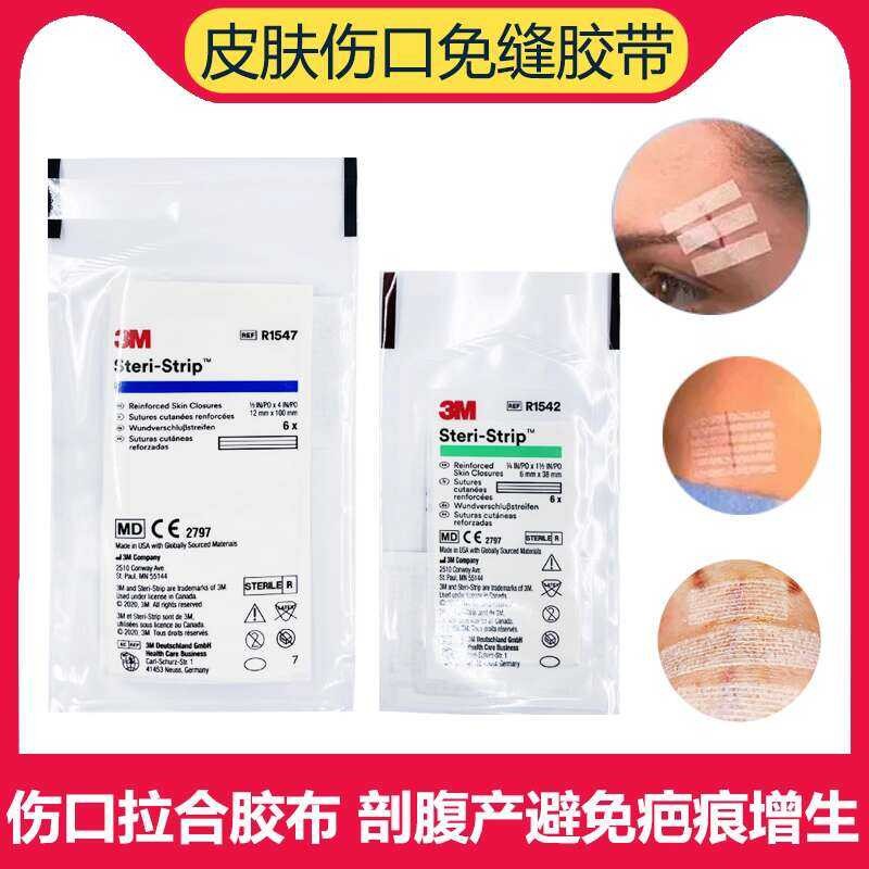 Tt 3M No-Sew Reduces Skin Wound Adhesion Tape Beauty Medical C-Section ...