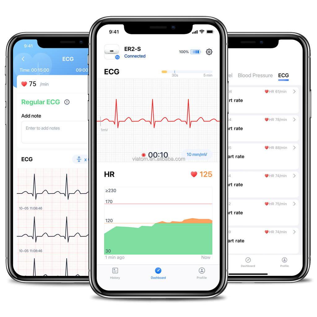 Wellue Holter Ecg Electrocardiogram Heart Rate Ecg Monitor Portable Ekg ...