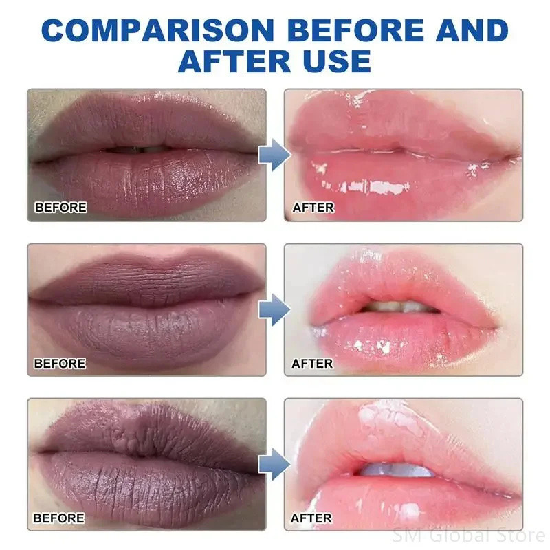 Remove Dark Lip Balm Lighten Melanin Lip Mask Exfoliating Fade Lip Line ...