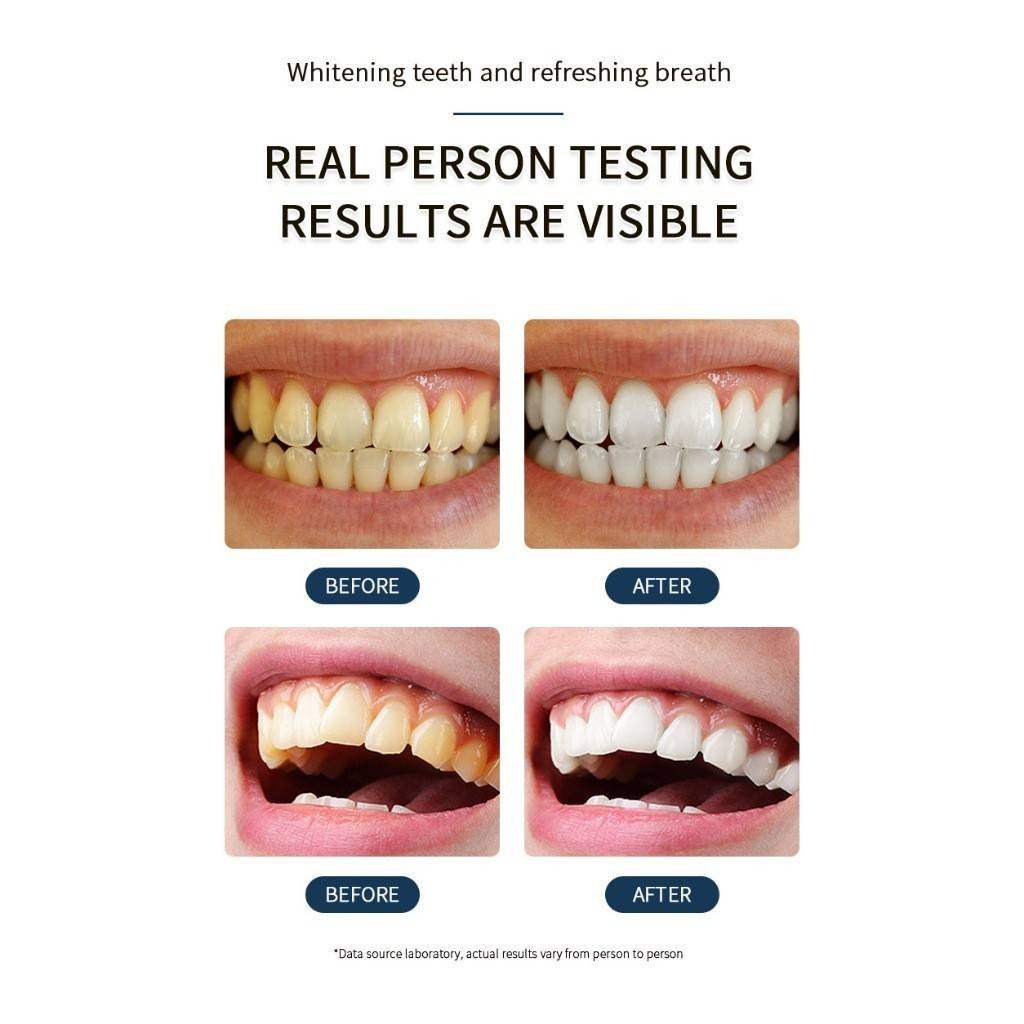 【Upgrade】scoban 20X teeth Whitening toothpaste Peppermint Food Graded ...
