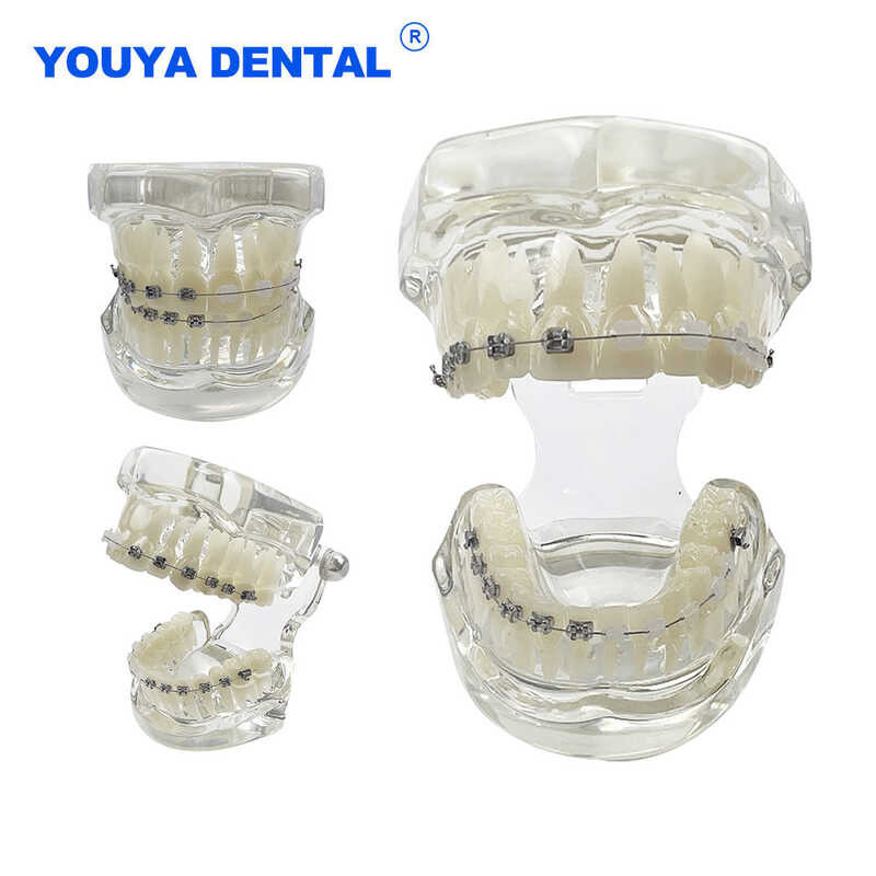 Standard Dental Orthodontic Teeth Model Transparent With Braces Metal ...