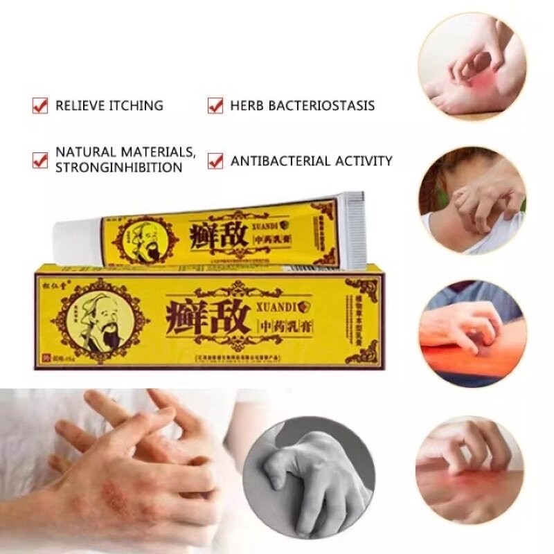 Y63 5pcs 100% XUANDI Krim Kurap Kudis Psiorasis Ekzema Panau Fungus ...
