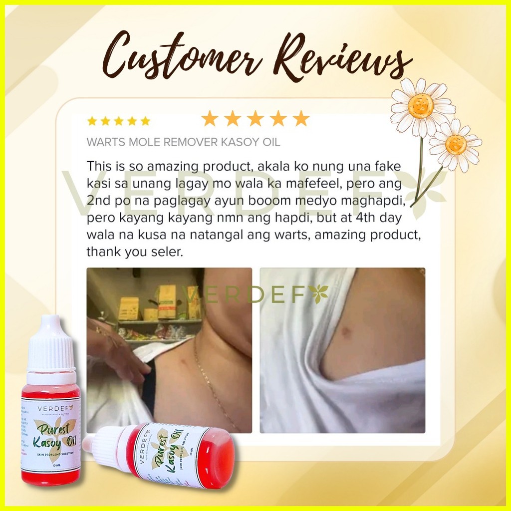 AUTHENTIC ORIGINAL KULUGO SYRINGOMA SKIN TAGS WARTS GENITAL WARTS ...