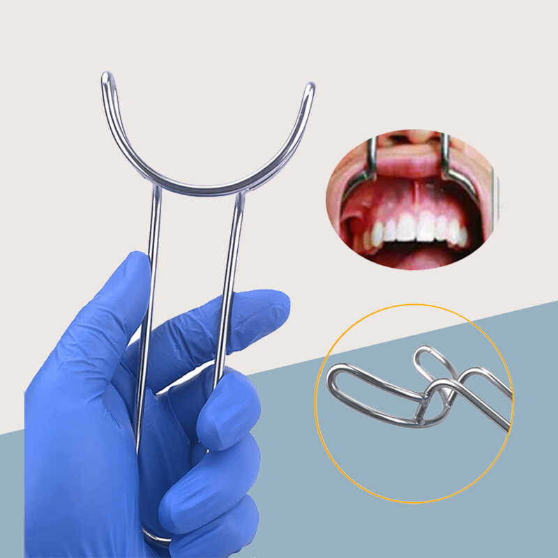 Stainless Steel Dental Mouth Expand Lip Retractor Intraoral Cheek Upper ...