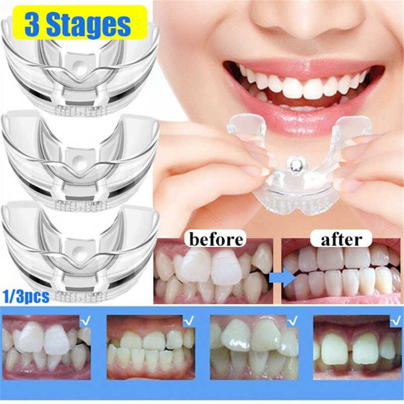 3 Stages Silicone Invisible Orthodontic Set Dental Appliance Teeth ...