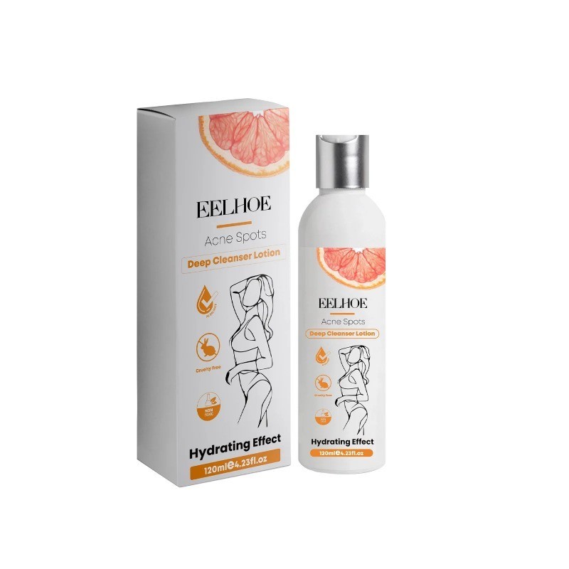 Anti Acne Body Lotion Back Butt Pimple Removal Moisturizing Whitening ...