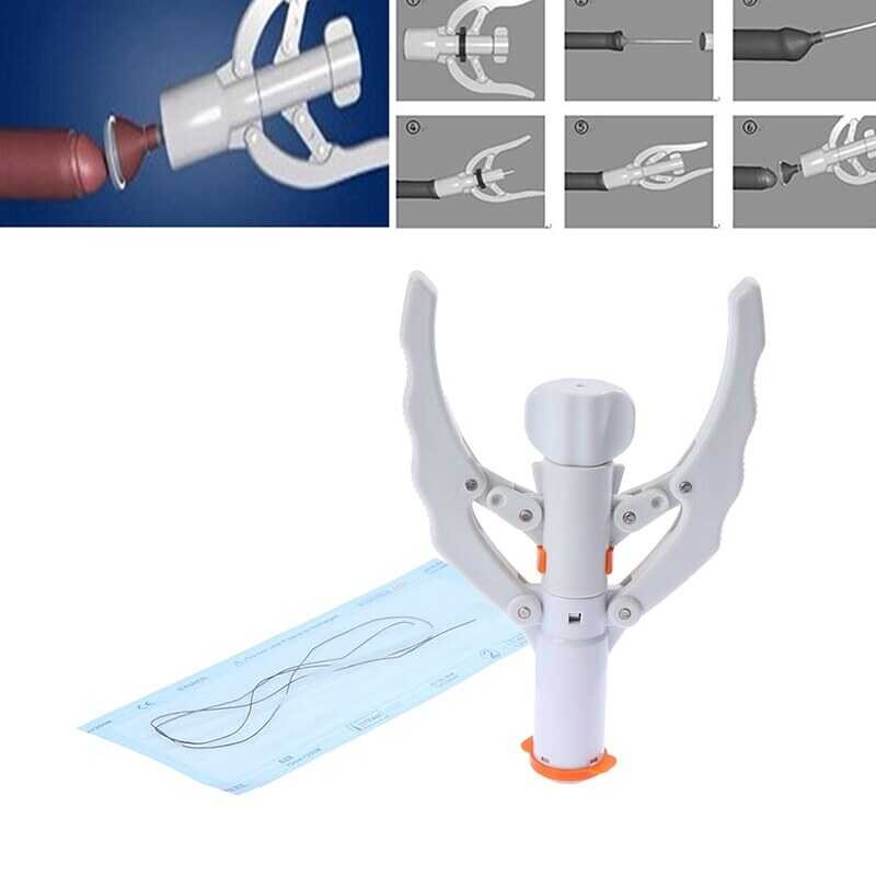 Disposable Foreskin Circumcision Stapler For Prepuce Genital Posthetomy Surgery Device Cut ...