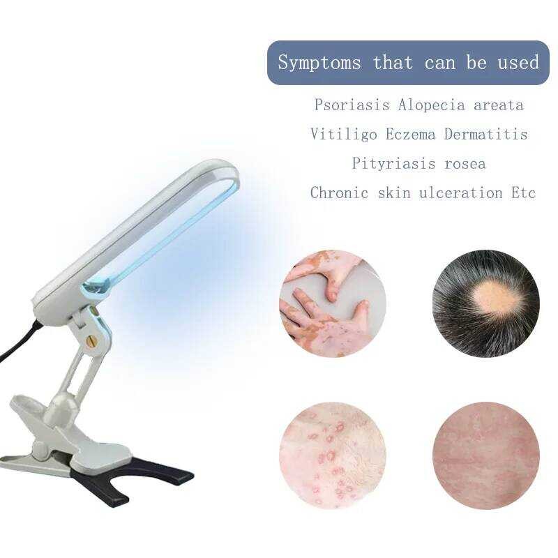 Of UVB Vitiligo Psoriasis Skin Treatm Light 311Nm Narrow Band ...