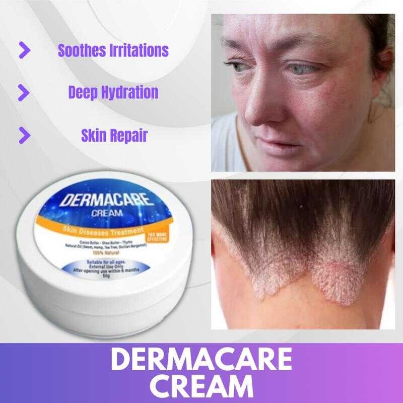 Dermacare Cream 50G – Intensive Skin Repair For Eczema, Psoriasis ...