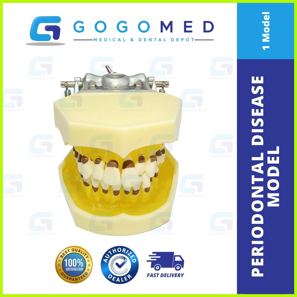 Periodontal Model 1 Model Perio Typo Jaw | Shopee Philippines