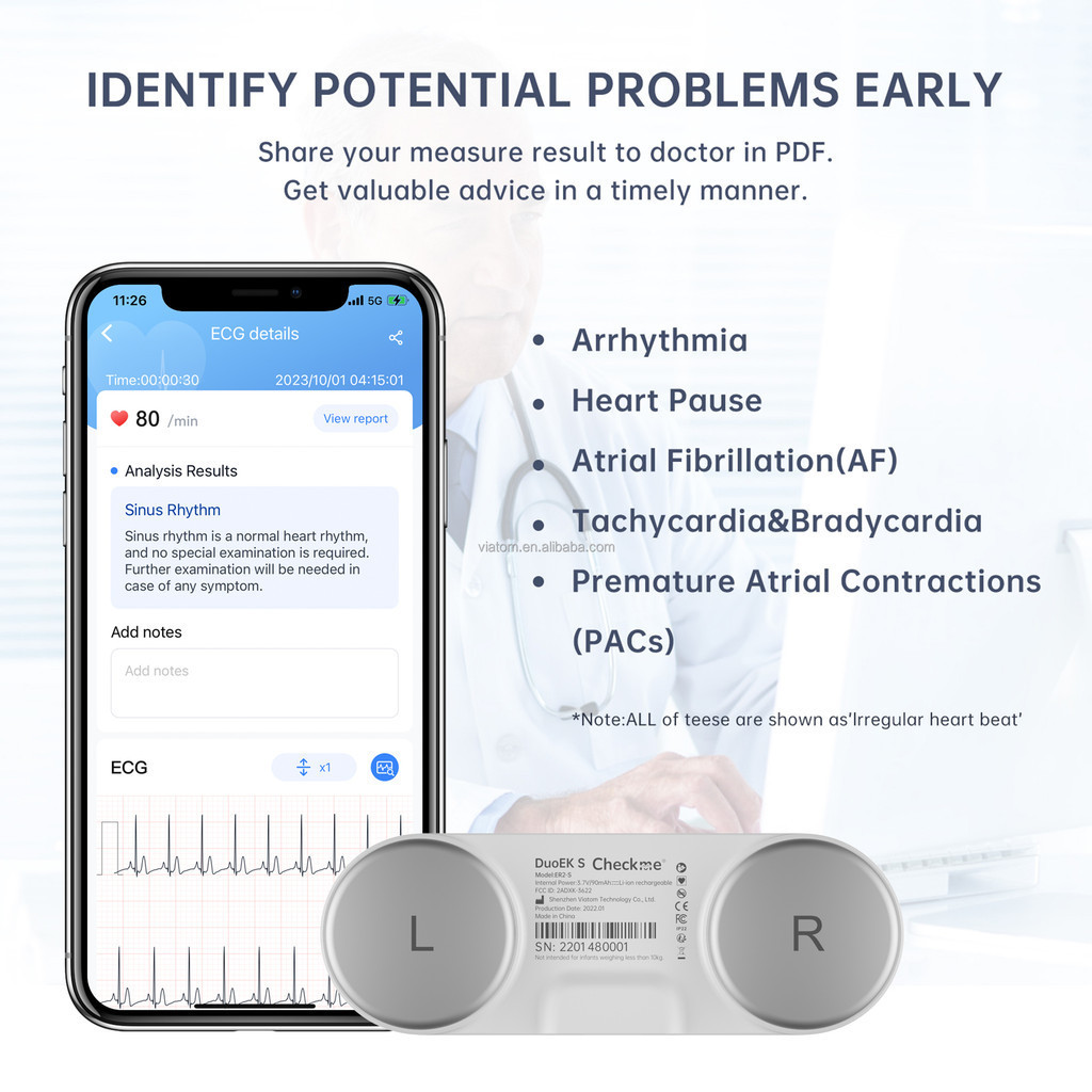 Wellue Holter Ecg Electrocardiogram Heart Rate Ecg Monitor Portable Ekg ...