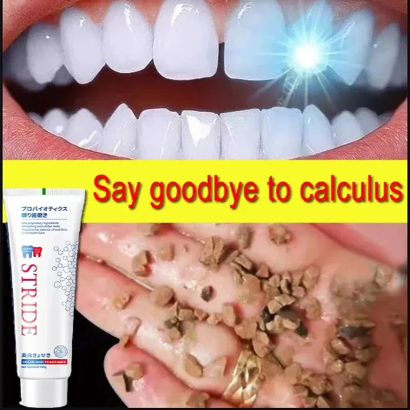 Calculus Remove Toothpaste Whitening Removal Bad Breath Teeth ...