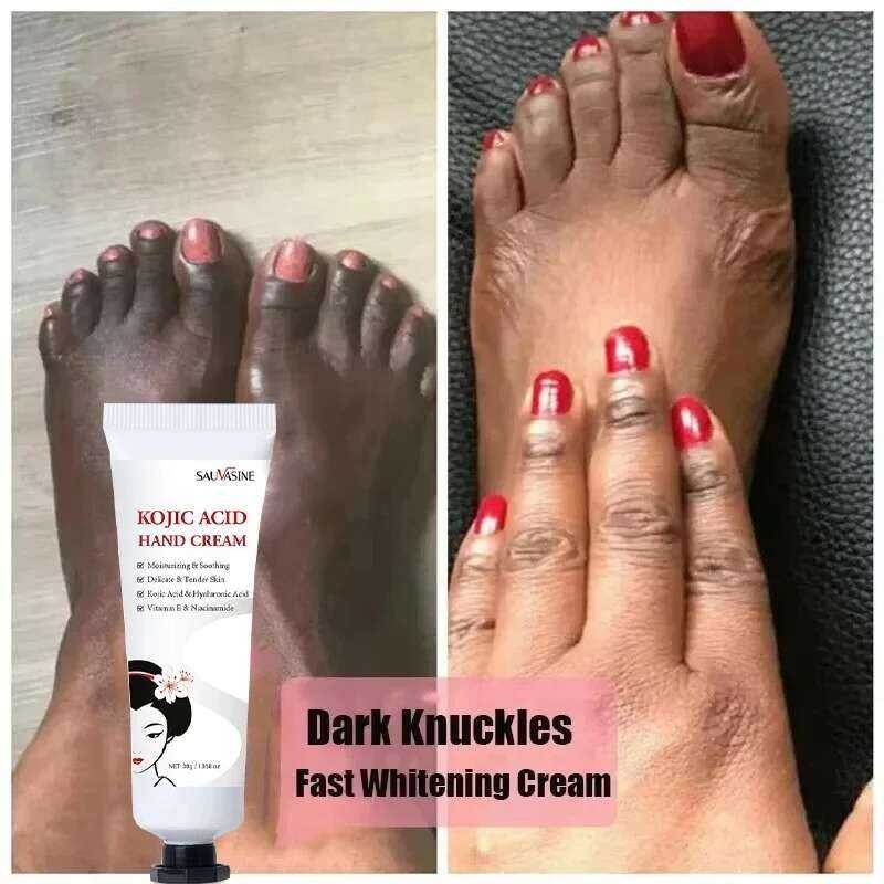 Dark Knuckles Fast Brighten Cream Elbows Hand Knuckle Brightening Serum ...