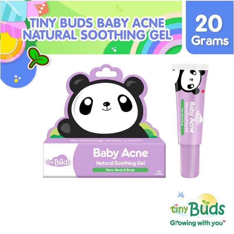 Tiny Buds Baby Acne Natural Soothing Gel (20G) | Shopee Philippines