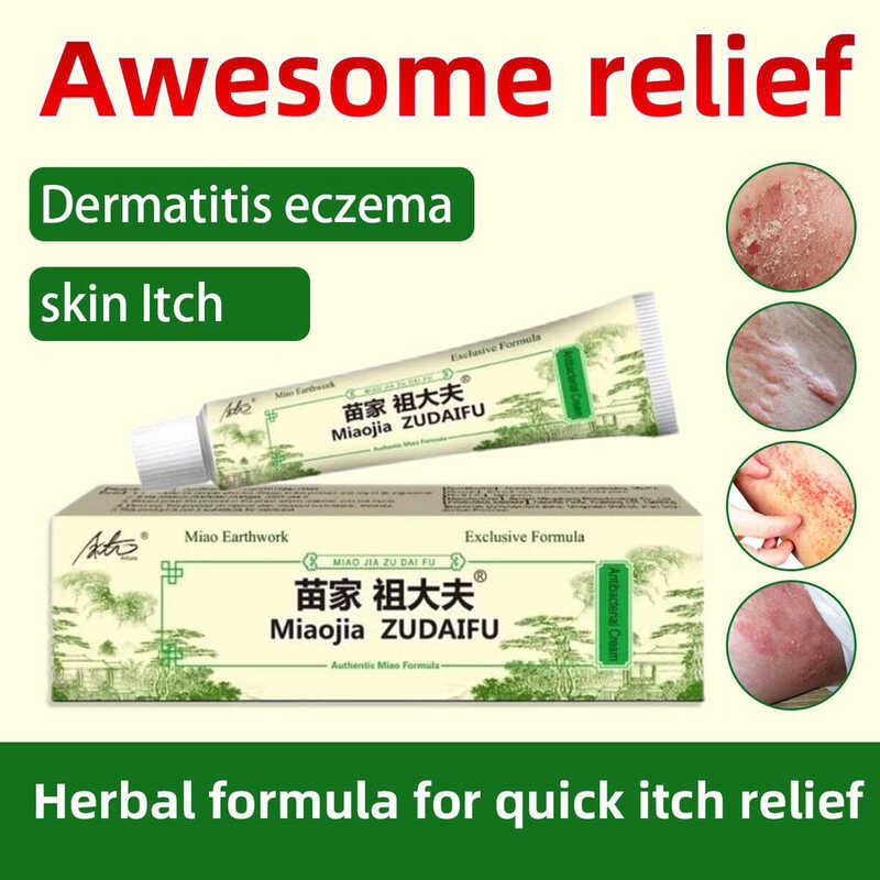 Psoriasis Natural Chinese HerbOintment Dermatitis Eczema Pruritu ...
