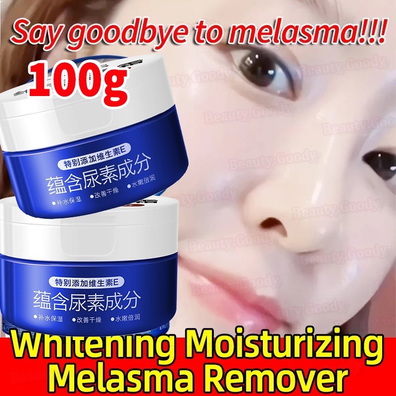 100g Whitening Melasma Cream Melasma Remover Pekas Remover Anti Freckle ...