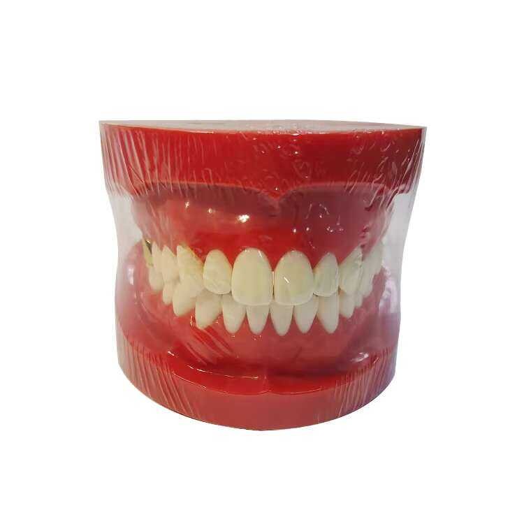 Removable Overlay Denture Restoration Teeth Model | Shopee Philippines