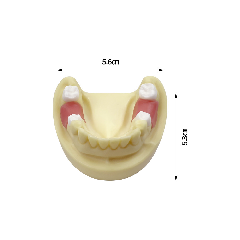 Teeth Dental Teaching Tooth Mandibular Jaw Implant Practice Dentistry ...