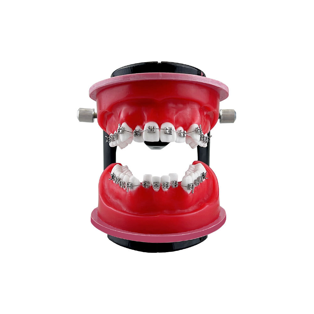 Dental Practice Teeth With Ortho Metal Brackets Orthodontic Model For ...
