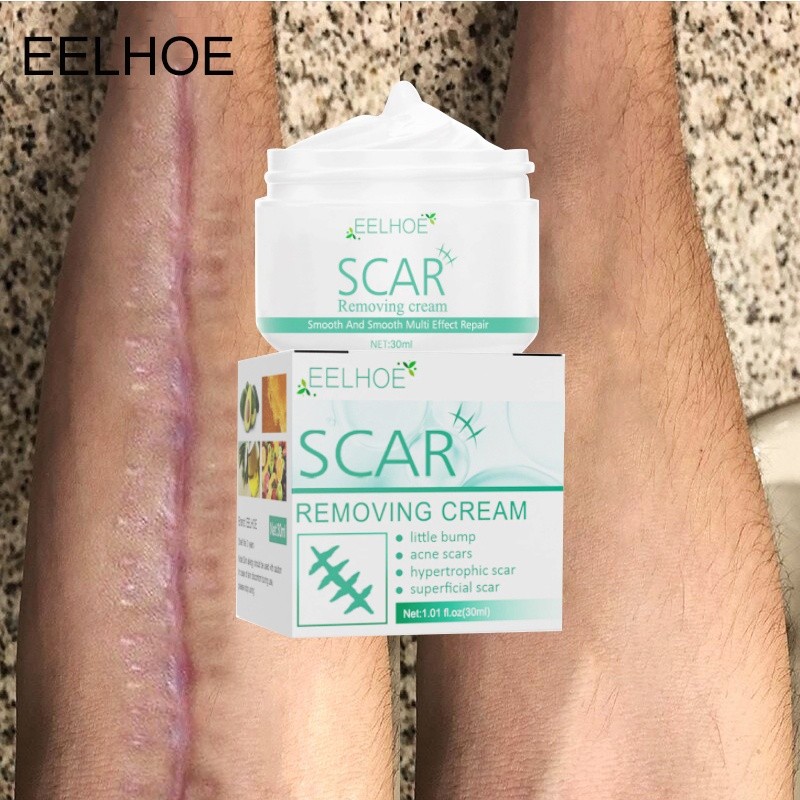 Effective Scar Remover for Old Scar on Leg Scar Gel Original Stretch ...
