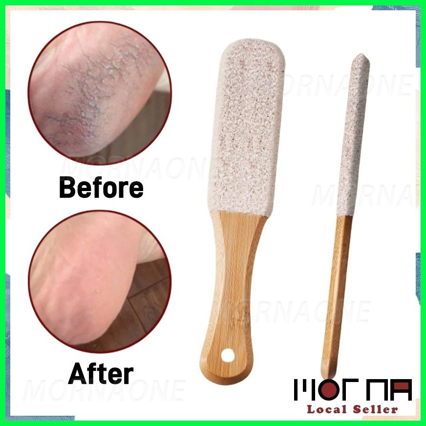 Four Sided Foot File Foot Scrubber Pedicure Tool Heel Grinder | Shopee ...