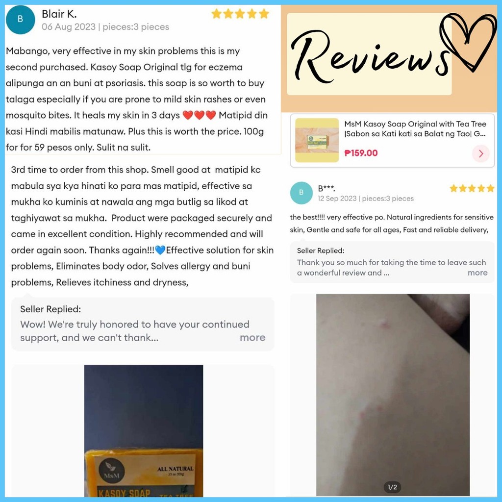 ☢ An An Remover Kasoy Soap: Skin Disease Treatment for Itchy, Buni ...