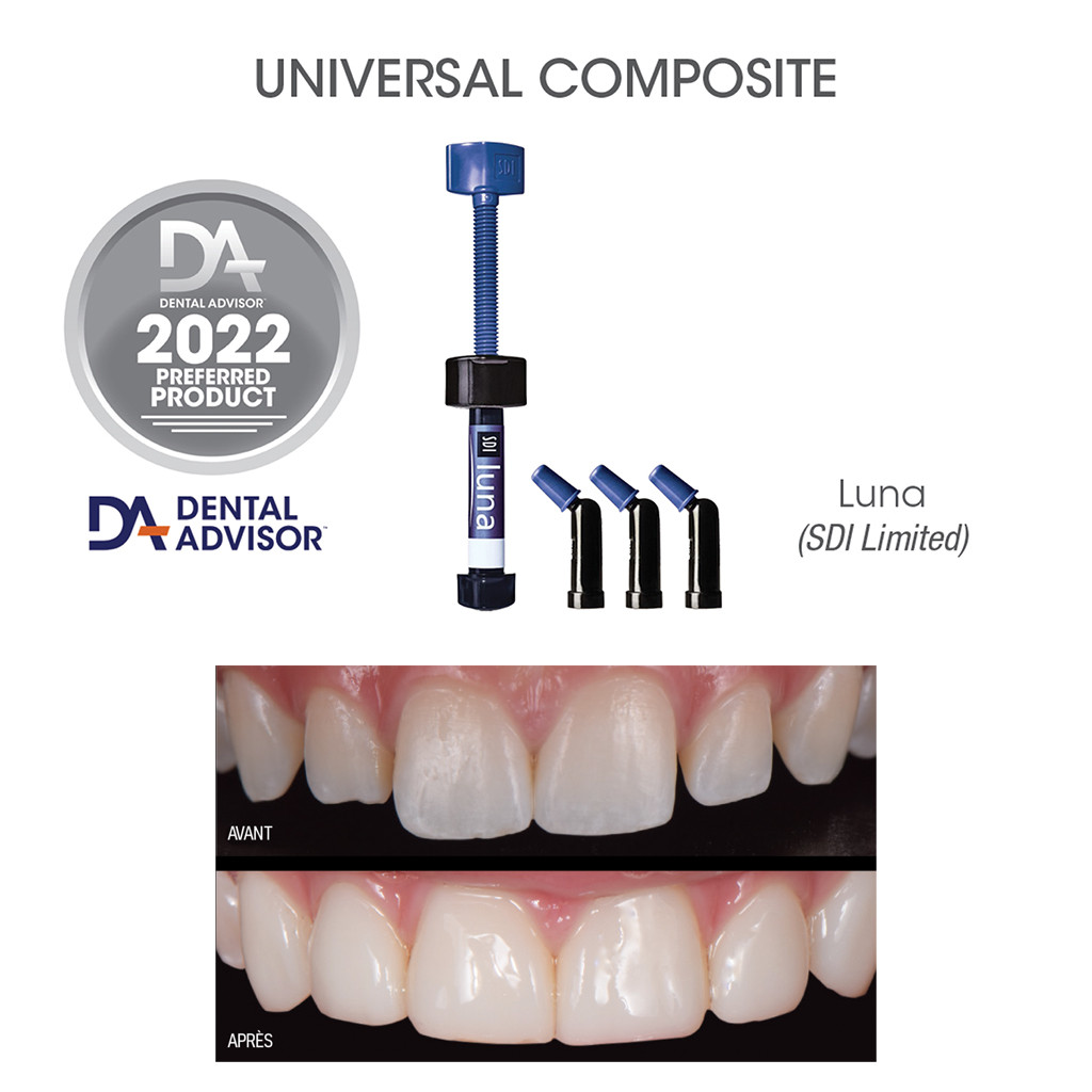 SDI LUNA nano hybrid composite 4g dental filling material a1 a2 a3 a3.5 ...
