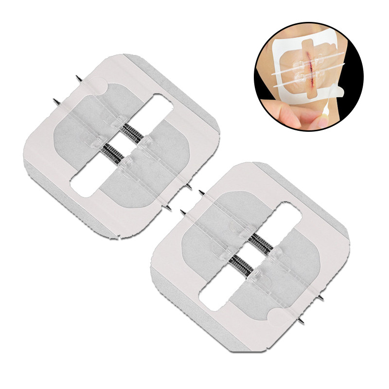 2PCS Medical Skin Wound Suture Device Zipper Wound Closure Hemostatic ...