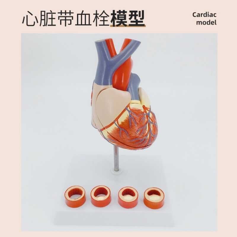 Anatomy model of human heart, color ultrasound, heart specimen, heart ...
