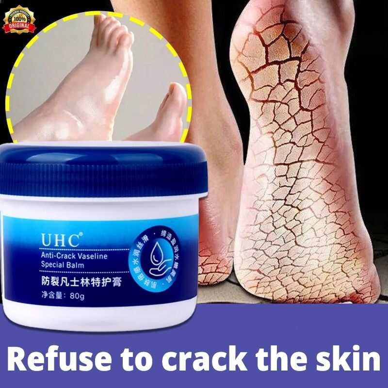 Whitening Niacinamide Moisturizing Lotion Heel Heal Cream Cracking ...