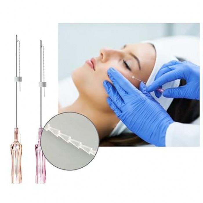 Minerva Fishbone Pdo Threads for Face lift - PDO Cog Threads Whole Body ...