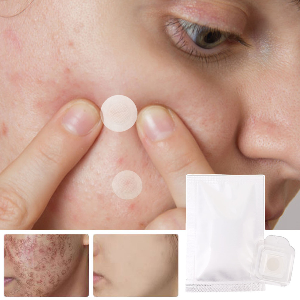 Targeted Key Treatment Salicylic Acid Acne Patch - Safe Harmless ...