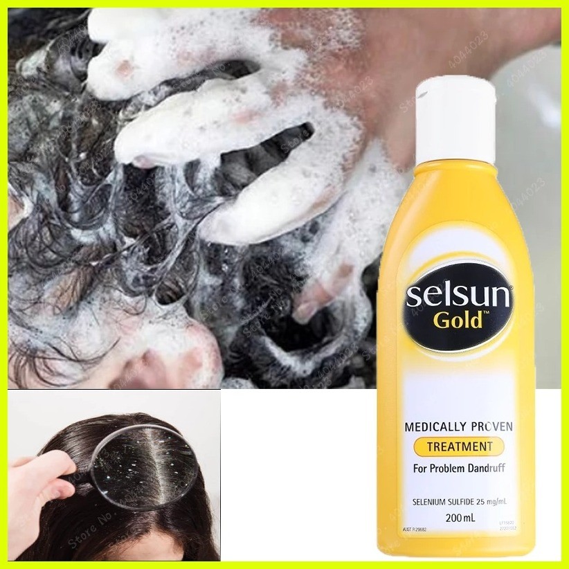 Selsun Gold Dandruff Medicated Shampoo Treatment Anti Dandruff ...