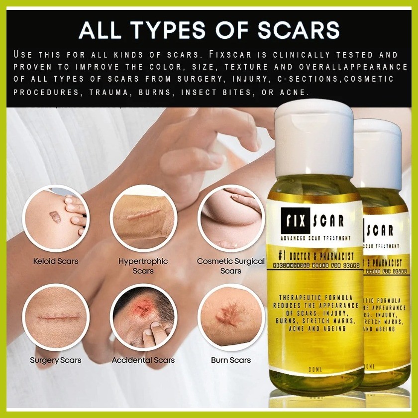 ∢ FIXSCAR ADVANCED SCAR TREATMENT (Para sa peklat, Melasma, Keloids ...