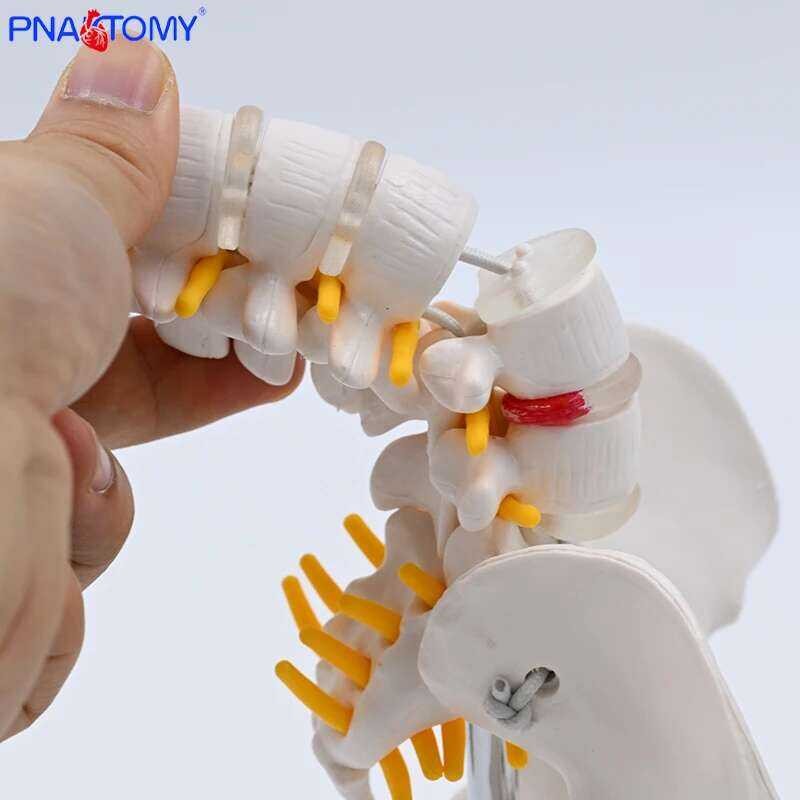 Mini Human Movable Peic Model, Lumbar S e, Postpartum Repair Of Peic ...