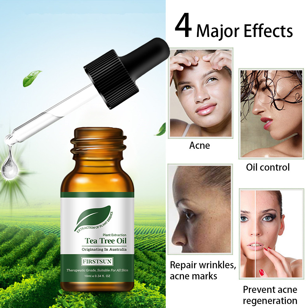 Tea Tree Control To Pore Removal Moisturizing Acne Treatment Oil ...