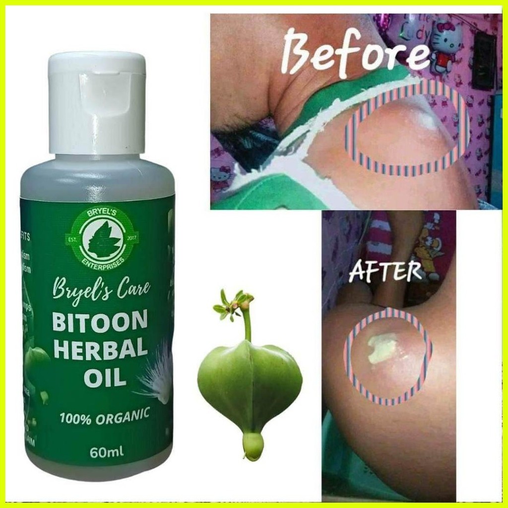 BRYELS CARE 60ML BITOON HERBAL OIL ANTI BODY BUMPS Mabisang Pangtunaw sa Lahat ng Uri ng mga ...
