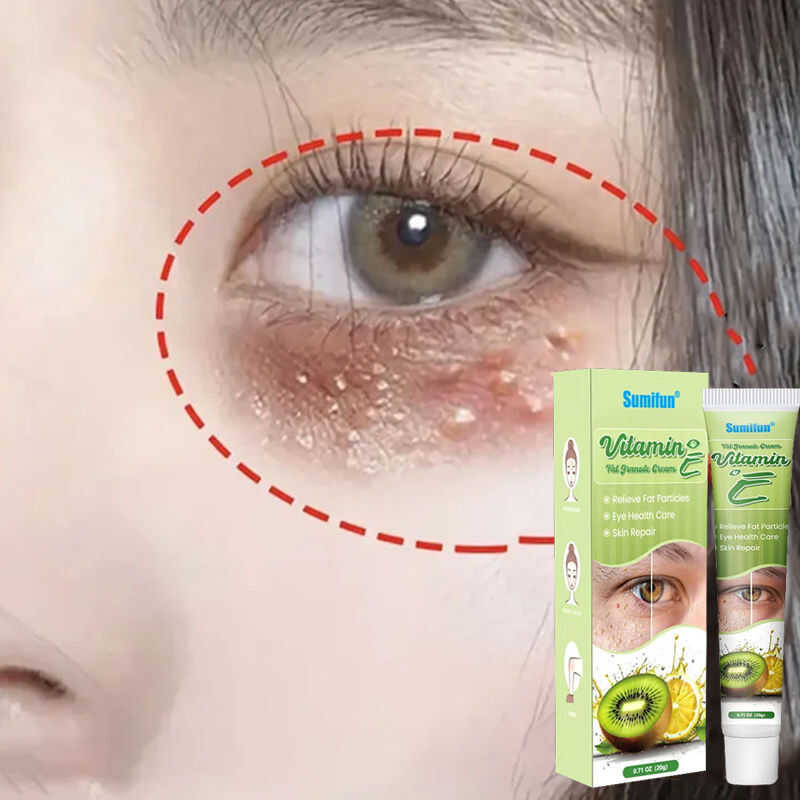 Whitening Niacinamide Vitamin E Krim Seed Cream Fat Granule Syringoma ...