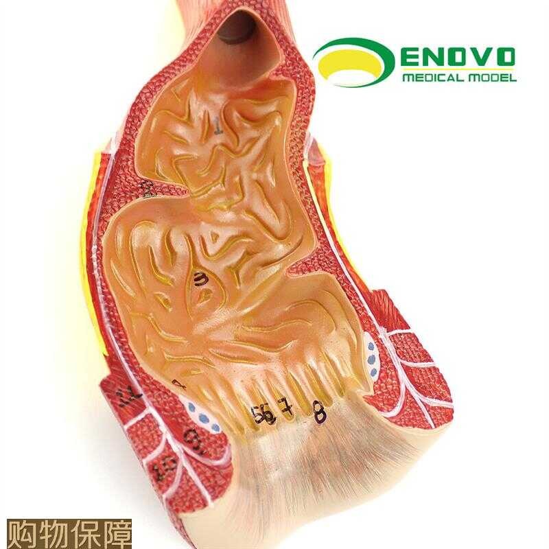 ENOVO Medical Anatomy Model of Human Rectum, Anal Canal, Anal Structure ...